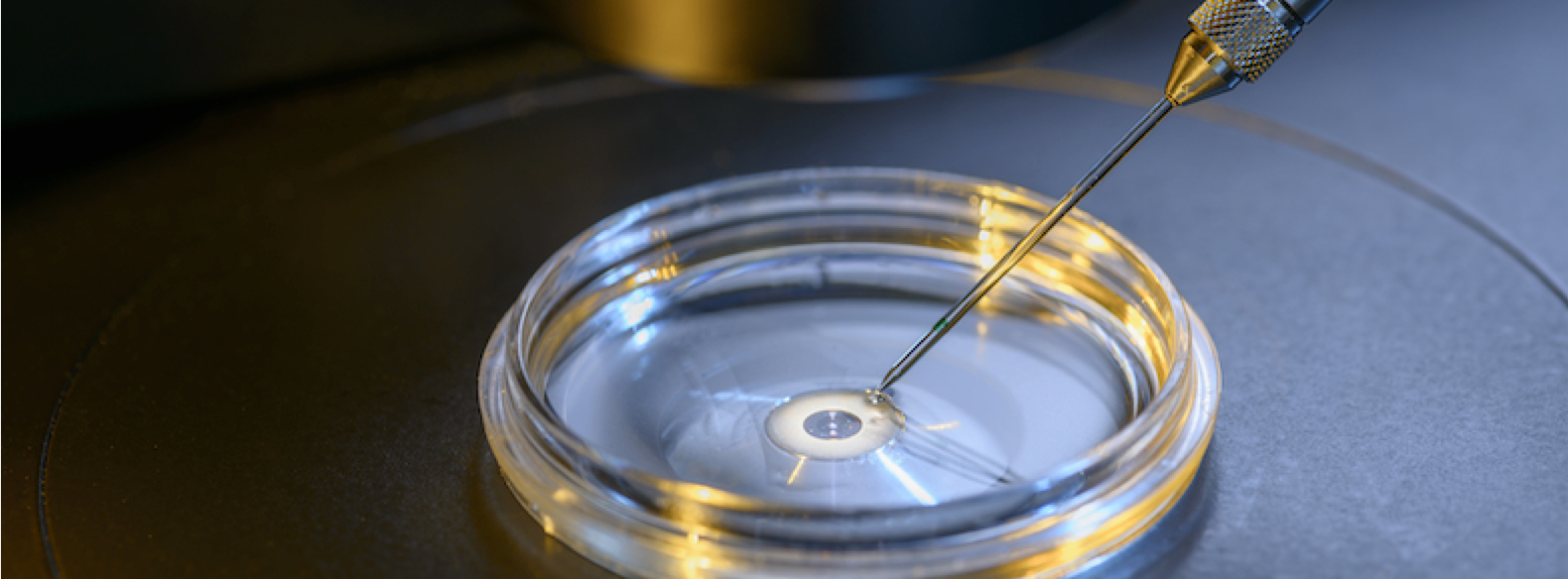 FIV en Turquie : pourquoi choisir Istanbul pour sa FIV ? | Body Expert