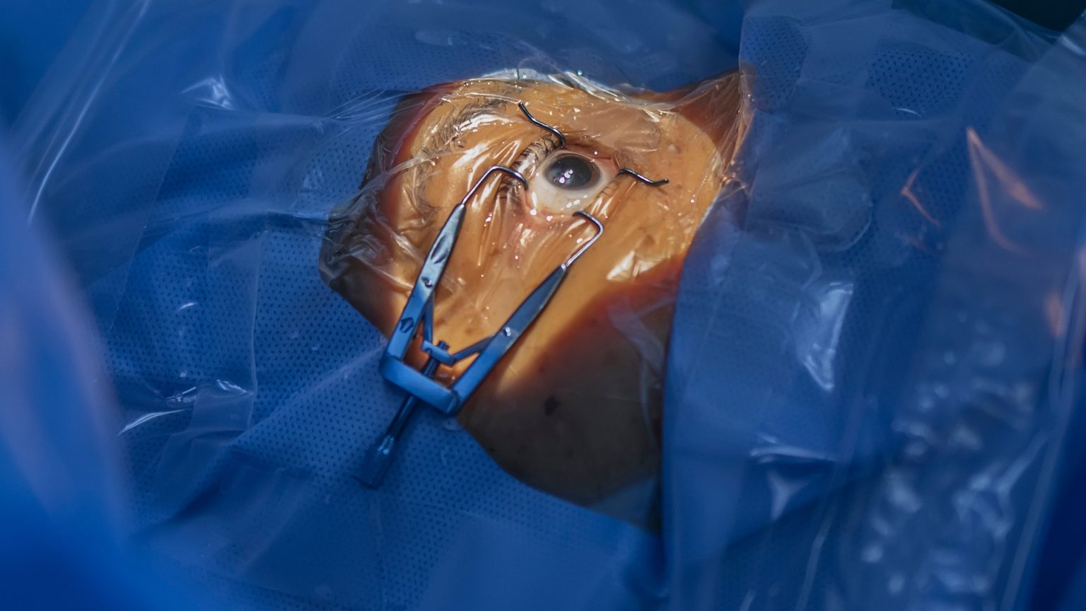 Multifocal IOL (intraocular lenses): pros and cons, prices and success rate