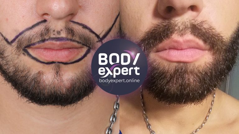 The art of the Turkish beard and mustache | Body Expert