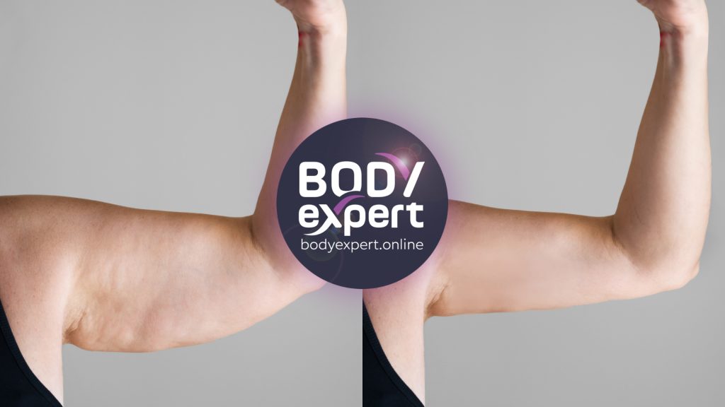 Liposuccion des bras : prix, procédure et résultats avant-après