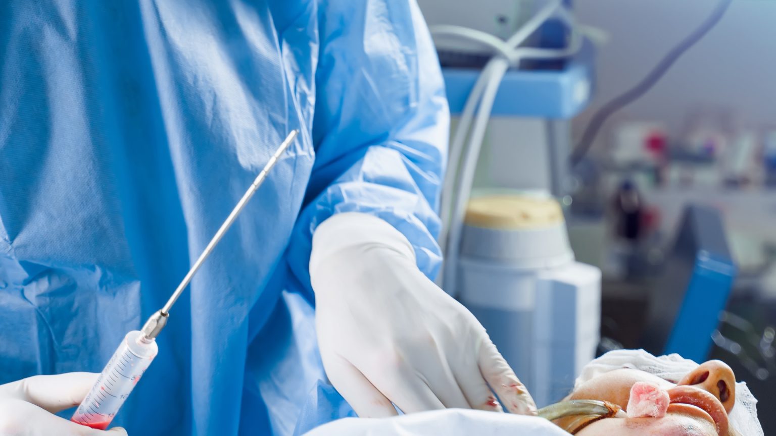 Liposuccion du cou : prix, procédure et résultats avant-après | Body Expert