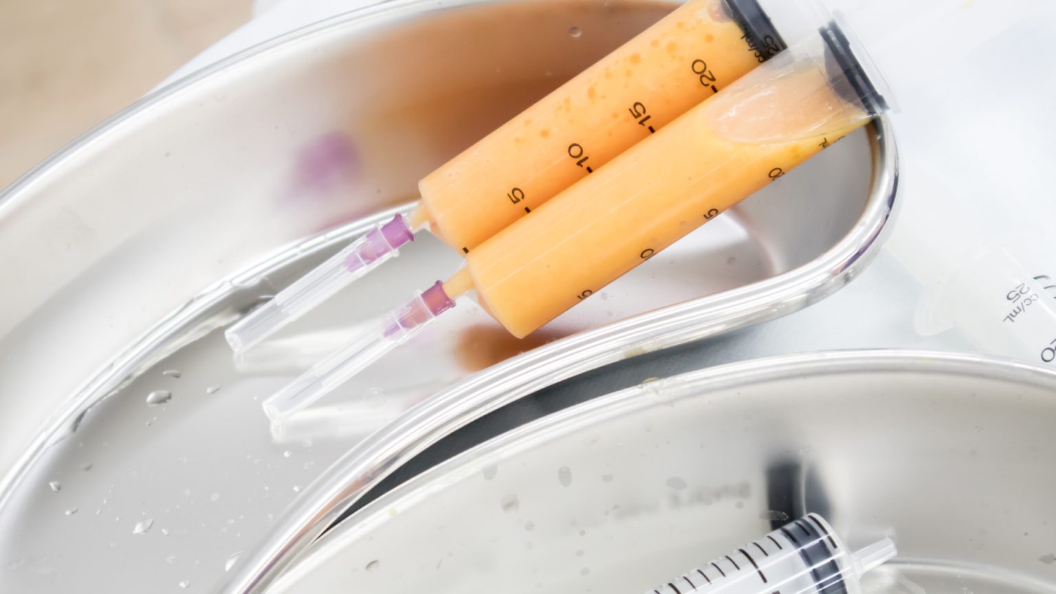 Hips liposuction: cost, procedure and results before and after