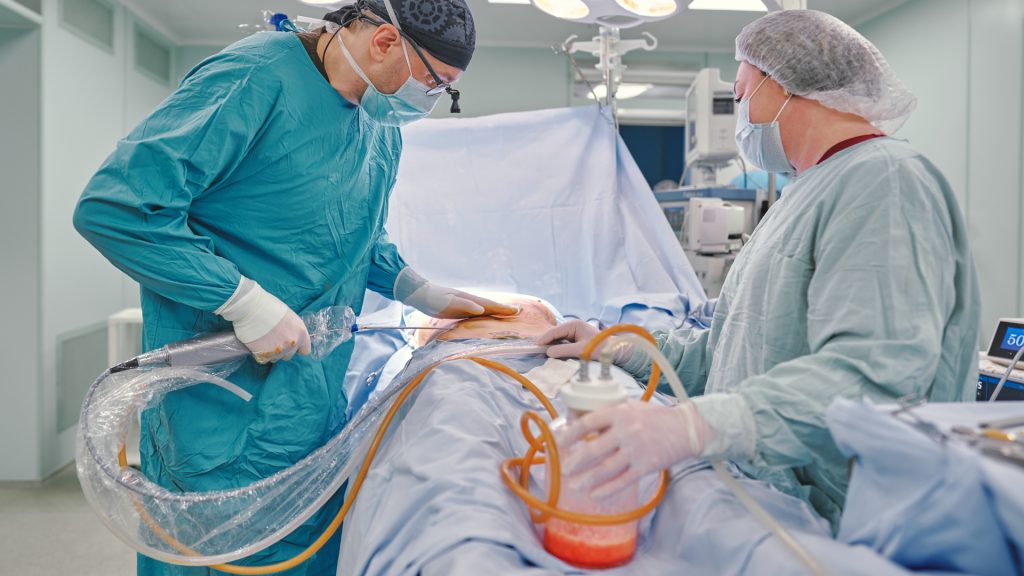 Love Handle Liposuction : cost, procedure, before and after