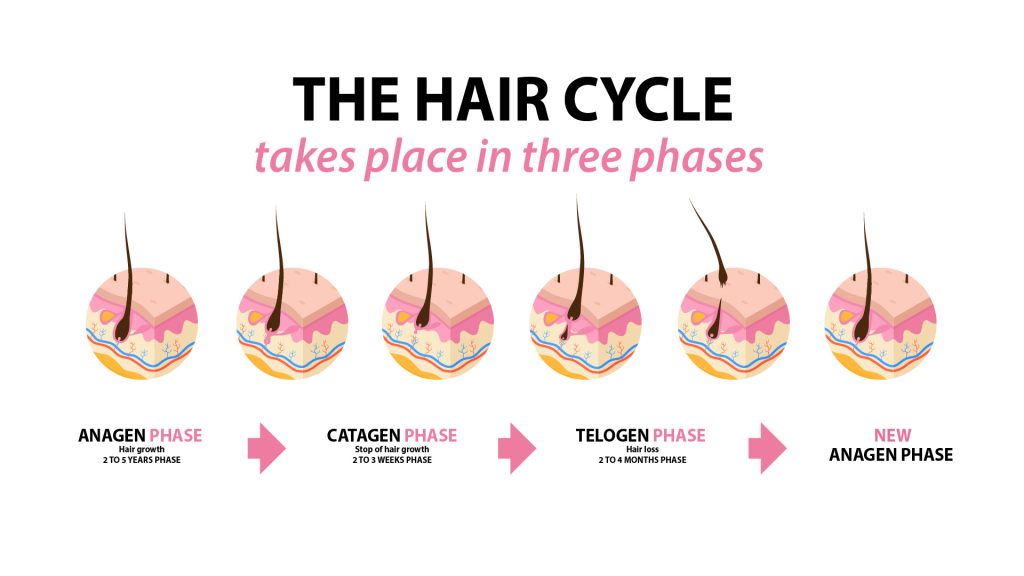 Shock Loss : the usual and temporary hair after a hair transplant