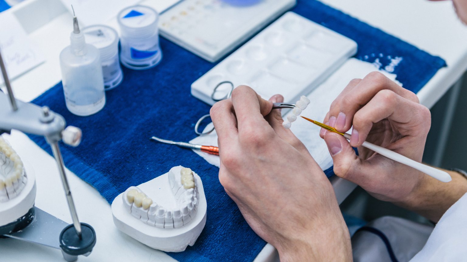 Prothèse dentaire fixe : tout savoir sur ses dispositifs