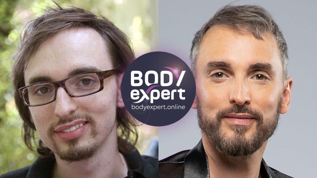 Greffe de cheveux : quelle star a des implants capillaires