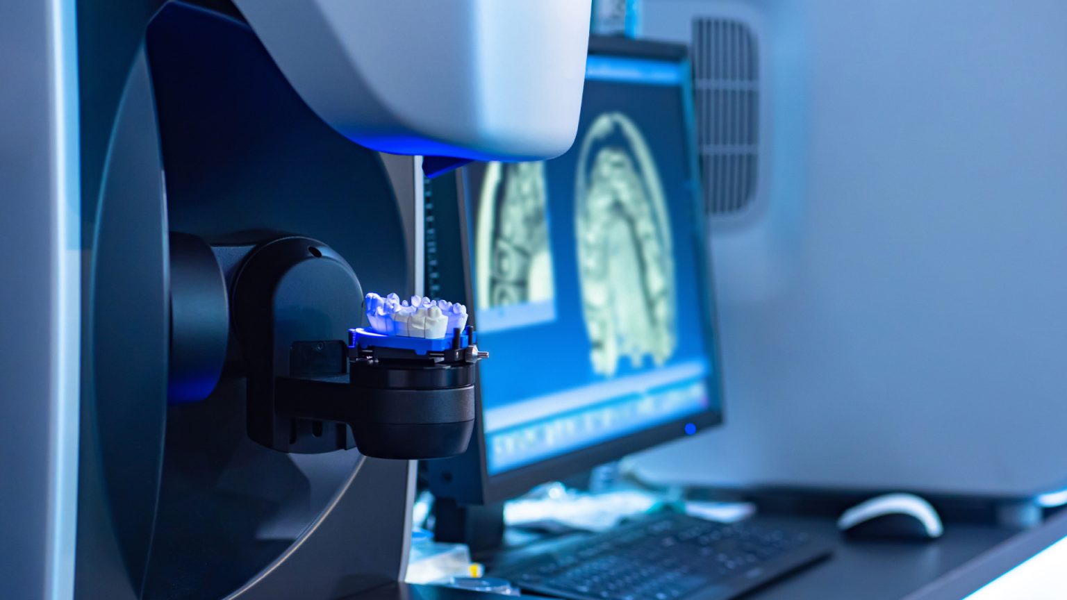 Dental Prostheses : types, prices, NHS coverage - The Complete Guide