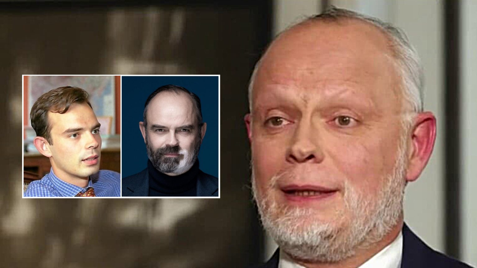 Alopécie : définition, causes, symptômes, types et traitements