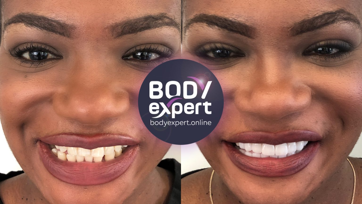 #Turkey Teeth: The Real Story Behind Dental Procedures in Turkey