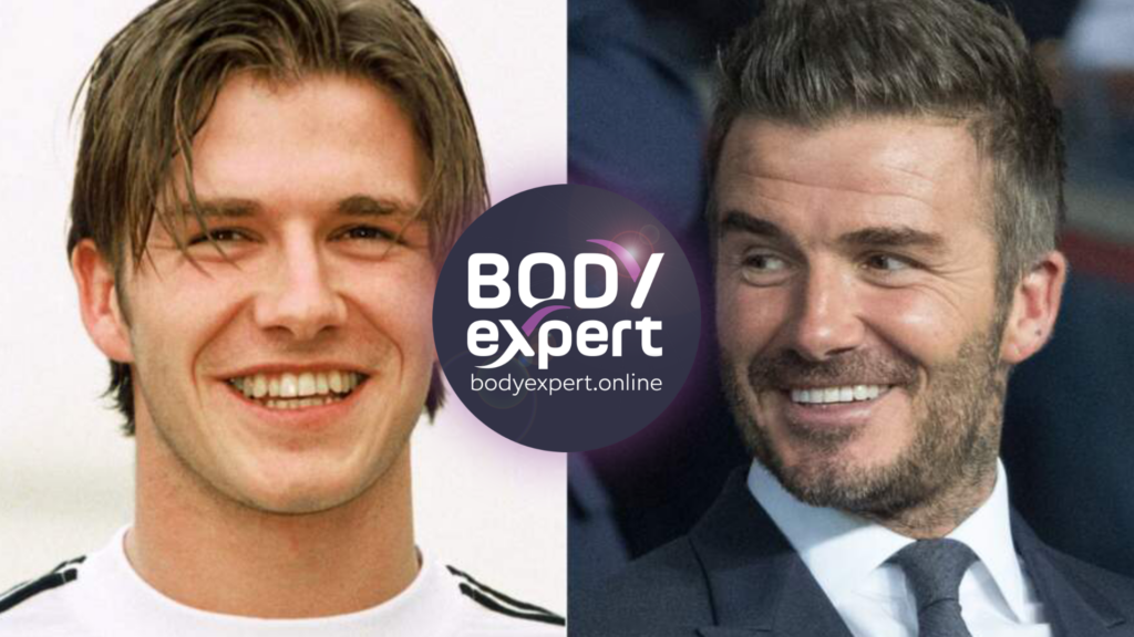 Celebrities with Veneers : the Hollywood Smile Rules