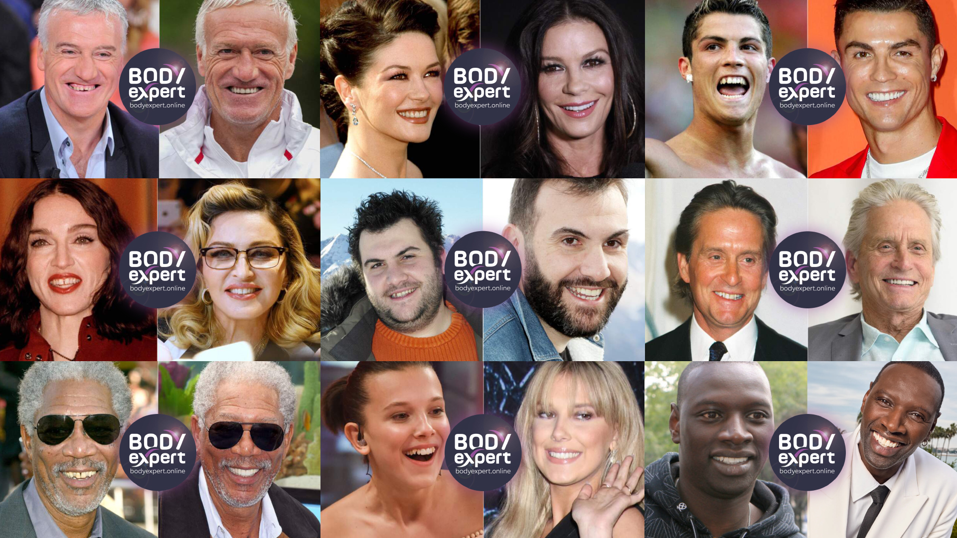 Norwood-Hamilton scale: the 7 stages of male pattern baldness