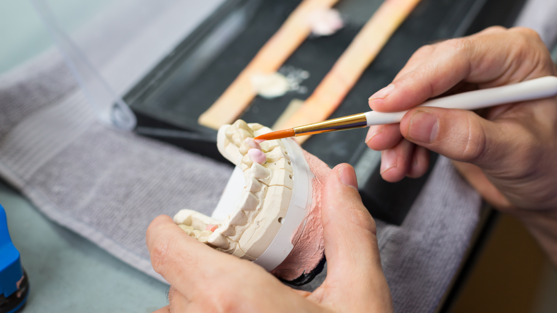 Inlay Onlay: Principles, Indications and Alternatives | Body Expert