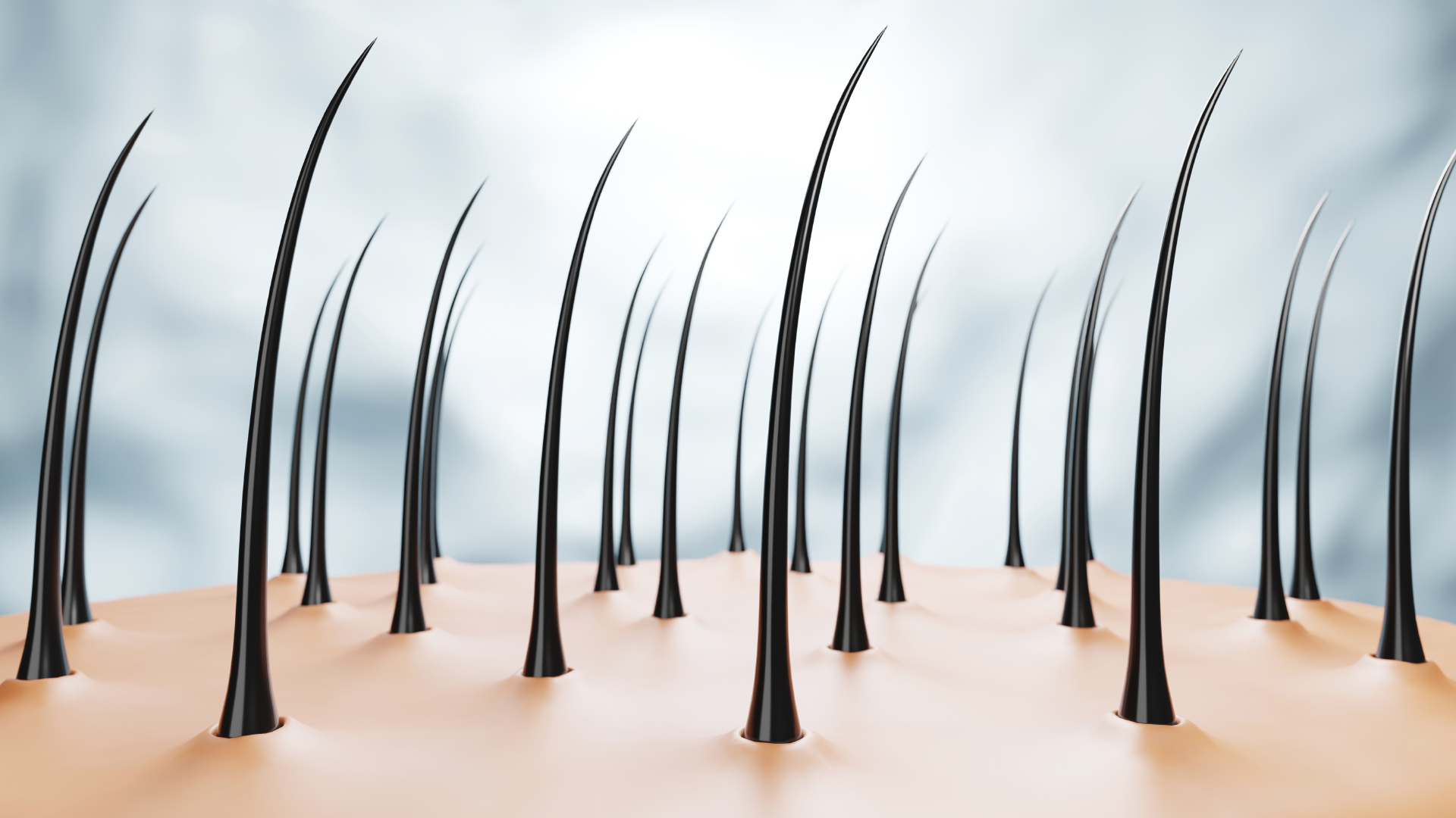 DHT and Hair Loss: Understanding This Hormone's Role in Alopecia | Body ...