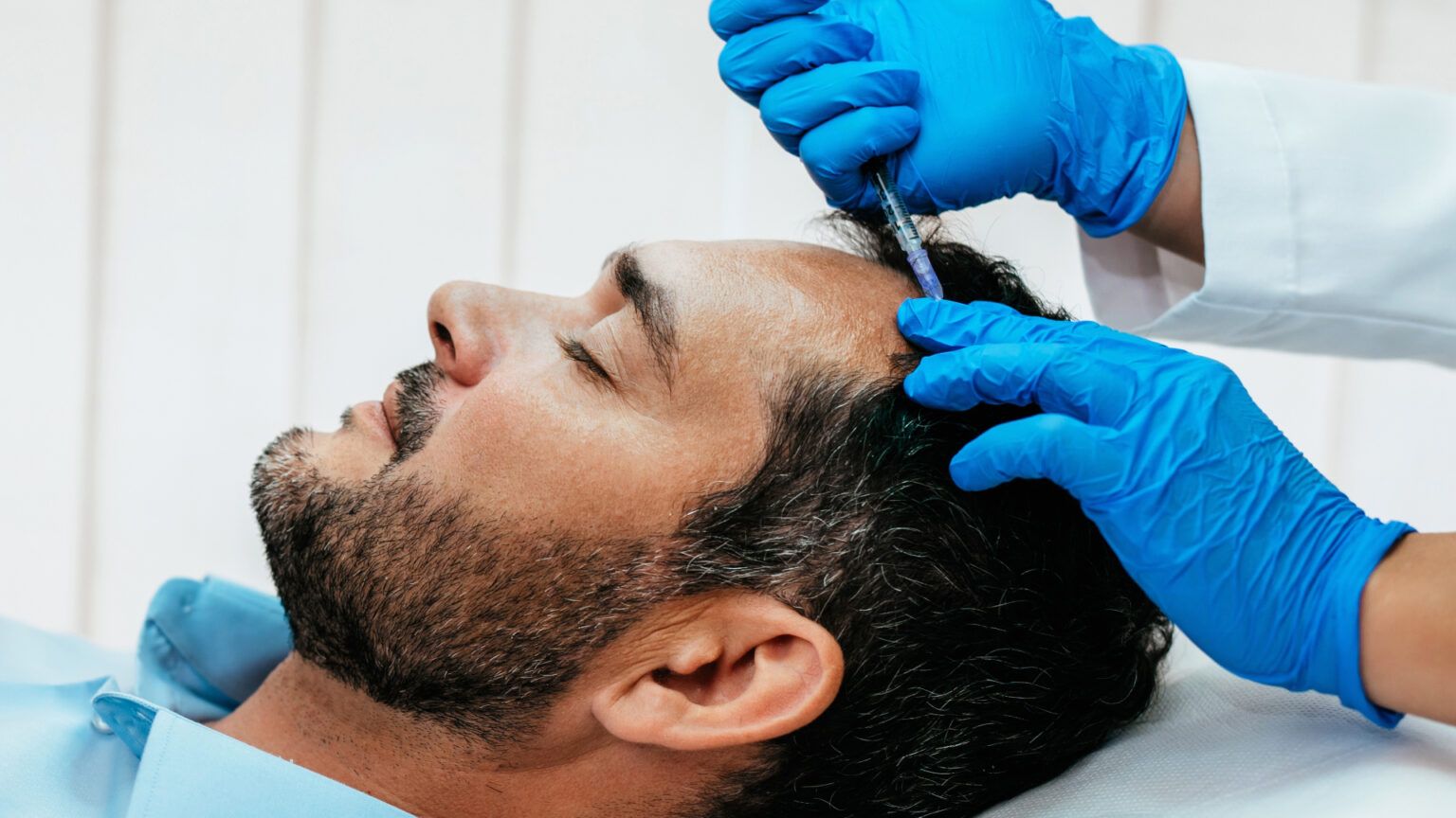 Receding Hairline & Temple Hair Loss: Causes, Stages and Effective ...